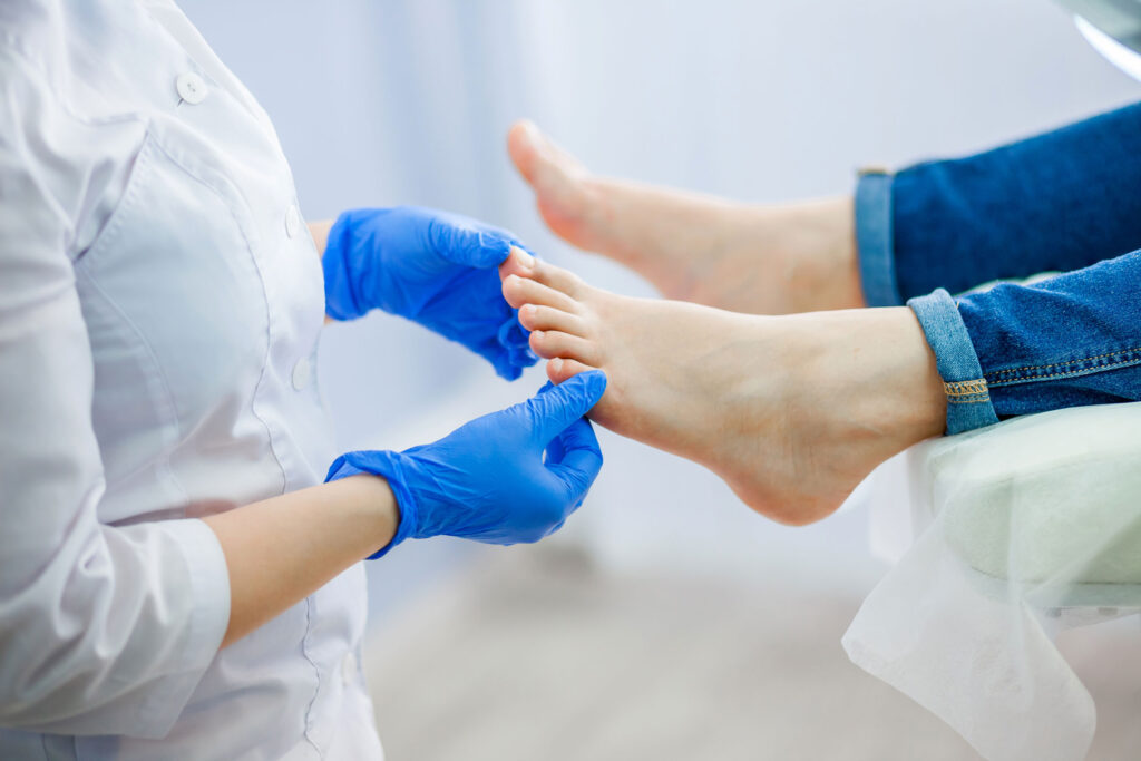 Pilzerkrankungen - Dermatologie in Schenefeld